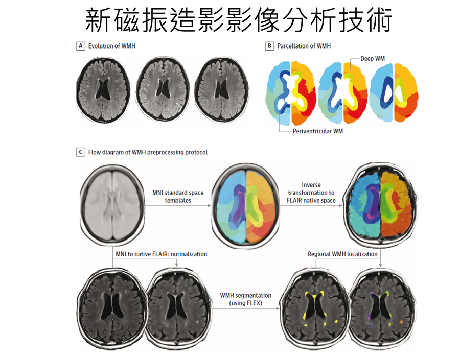 CTIMES/SmartAuto - 台医研团队利用新磁振造影技术 找出雷击头痛病理机转:科技部